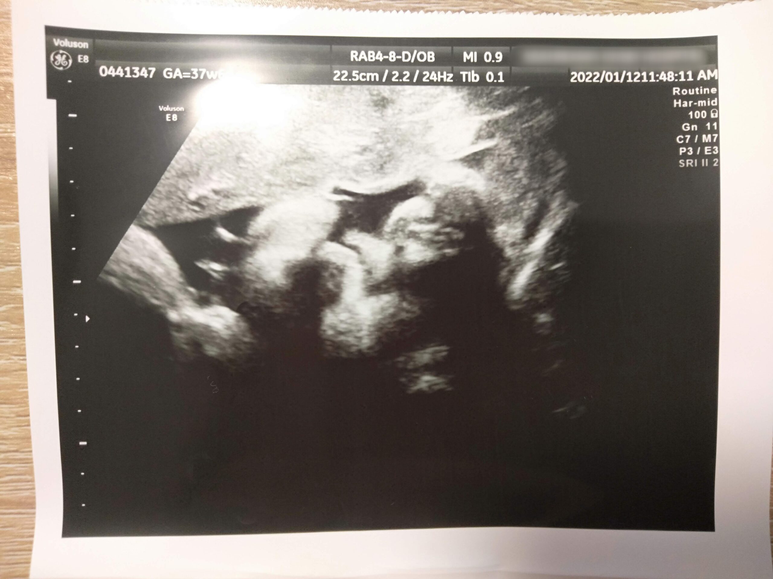 妊婦健診＊37w6d【私のわがままバースプラン】家族4人で最後の焼肉!!! | 沖縄移住からの北海道東川町へ地方移住『らしく』生きる家族